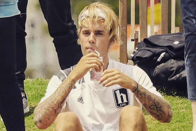 SBT TV | Eita! Justin Bieber radicaliza total e aparece careca