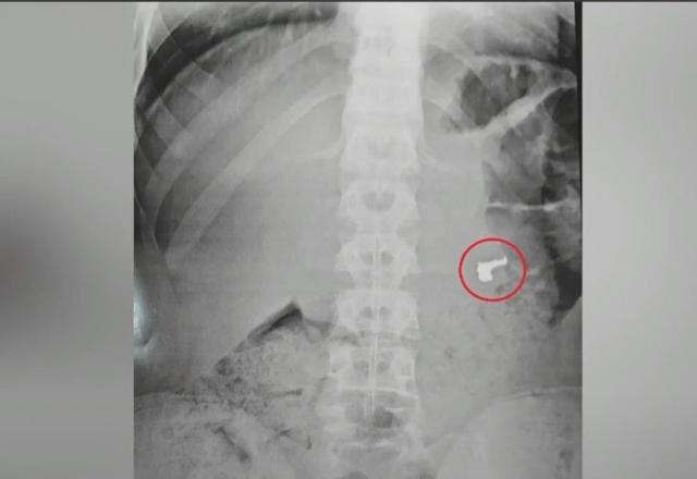 Adolescente engole corrente de ouro roubada na cidade de Guarujá - SBT