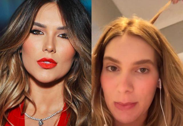 SBT TV | Virginia explica \"buracos\" no couro cabeludo após ...