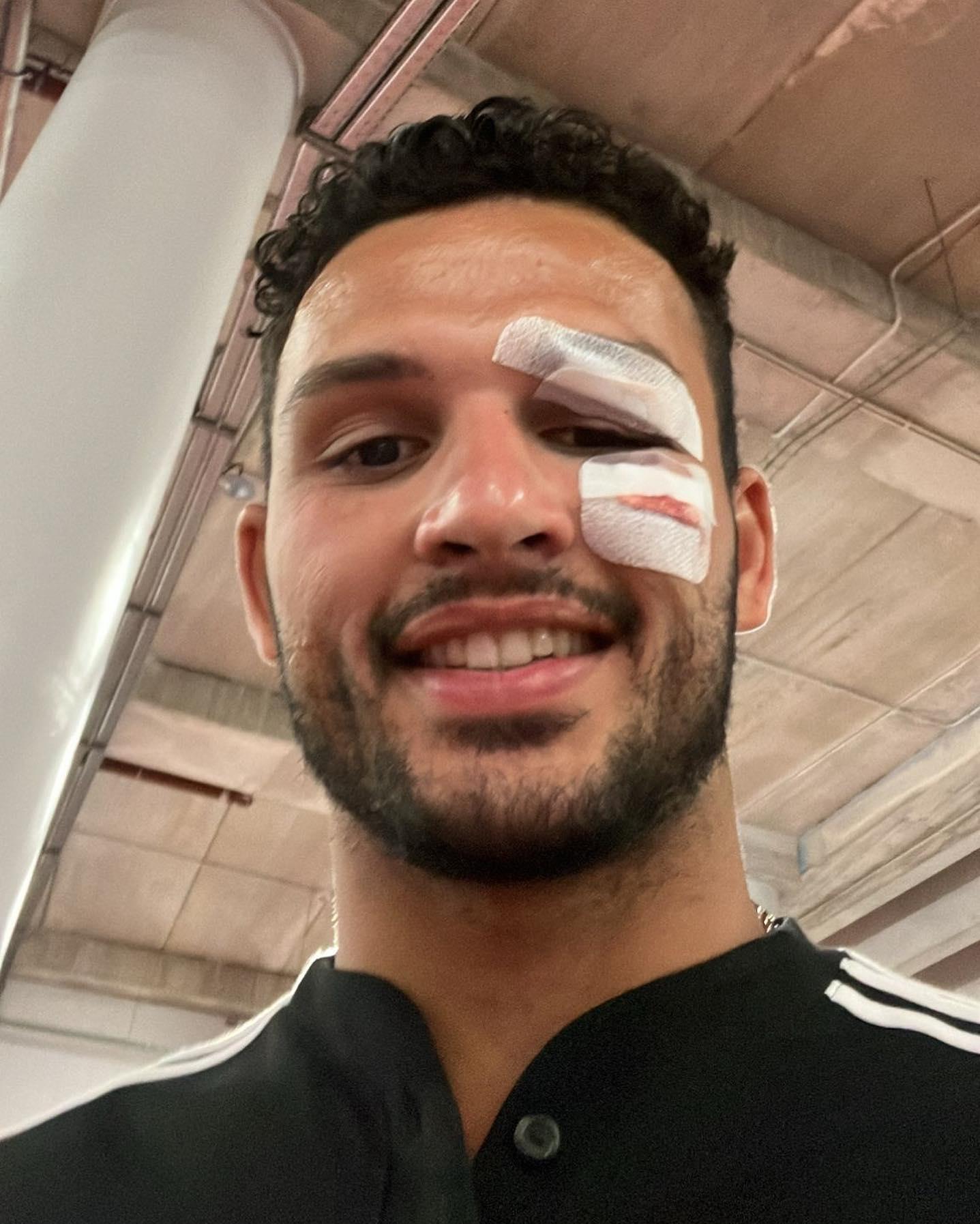 Atleta do Benfica fica com rosto deformado por choque em jogo da ...